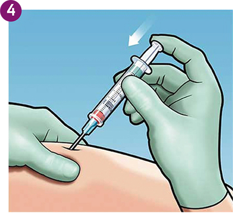 Administration | XOLAIR® (omalizumab) | HCP